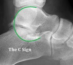 Question 219004 - Qbank - Orthobullets