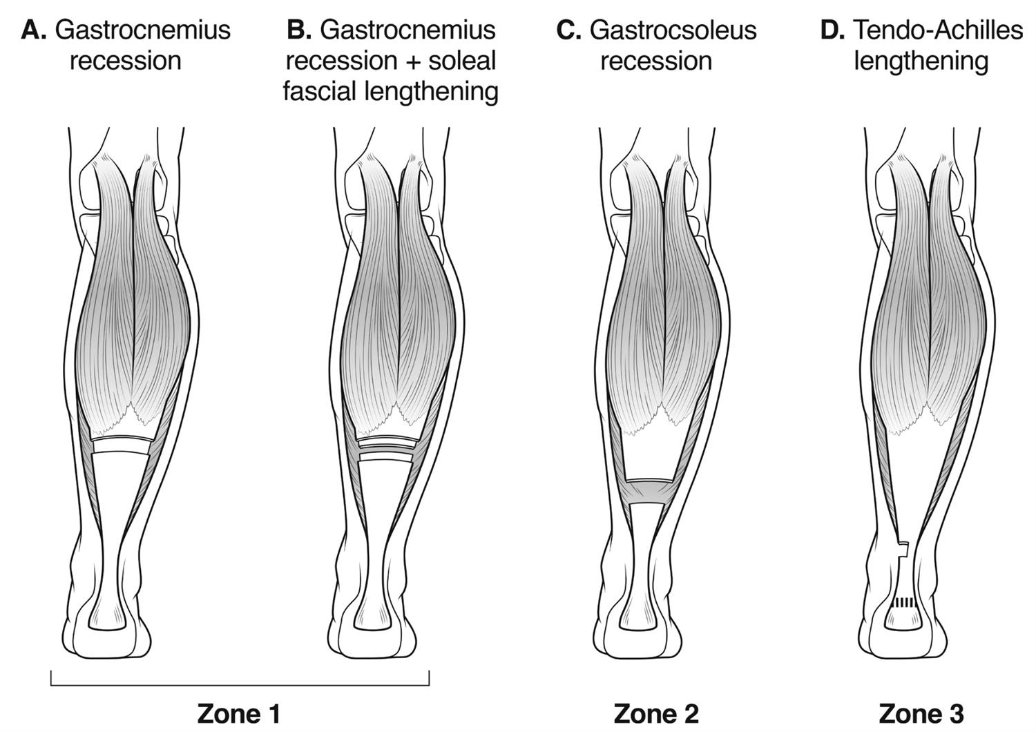 Question 219006 - Qbank - Orthobullets