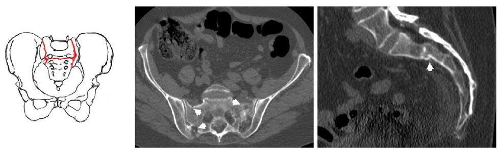 Question 219126 - Qbank - Orthobullets