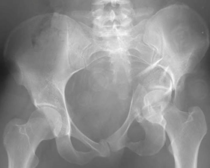 Question 219137 - Qbank - Orthobullets