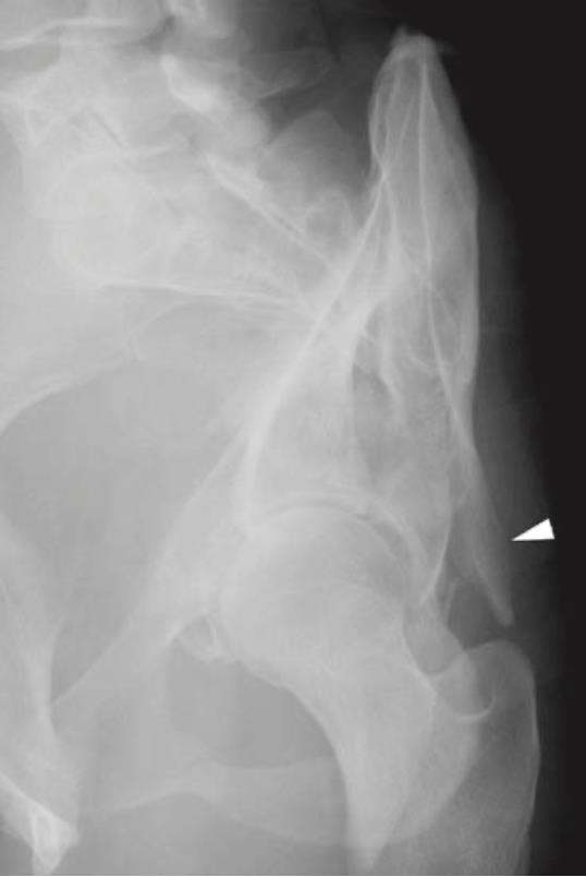 Question 219137 - Qbank - Orthobullets