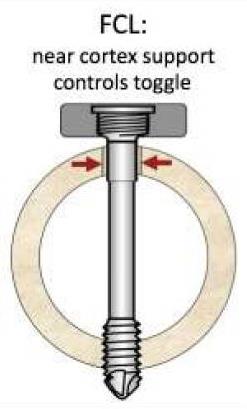 Question 219140 - Qbank - Orthobullets