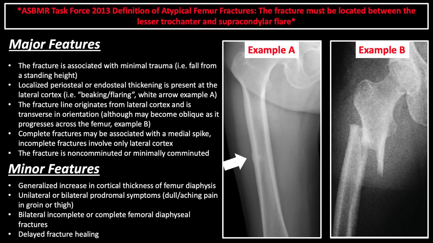 Question 219185 - Qbank - Orthobullets