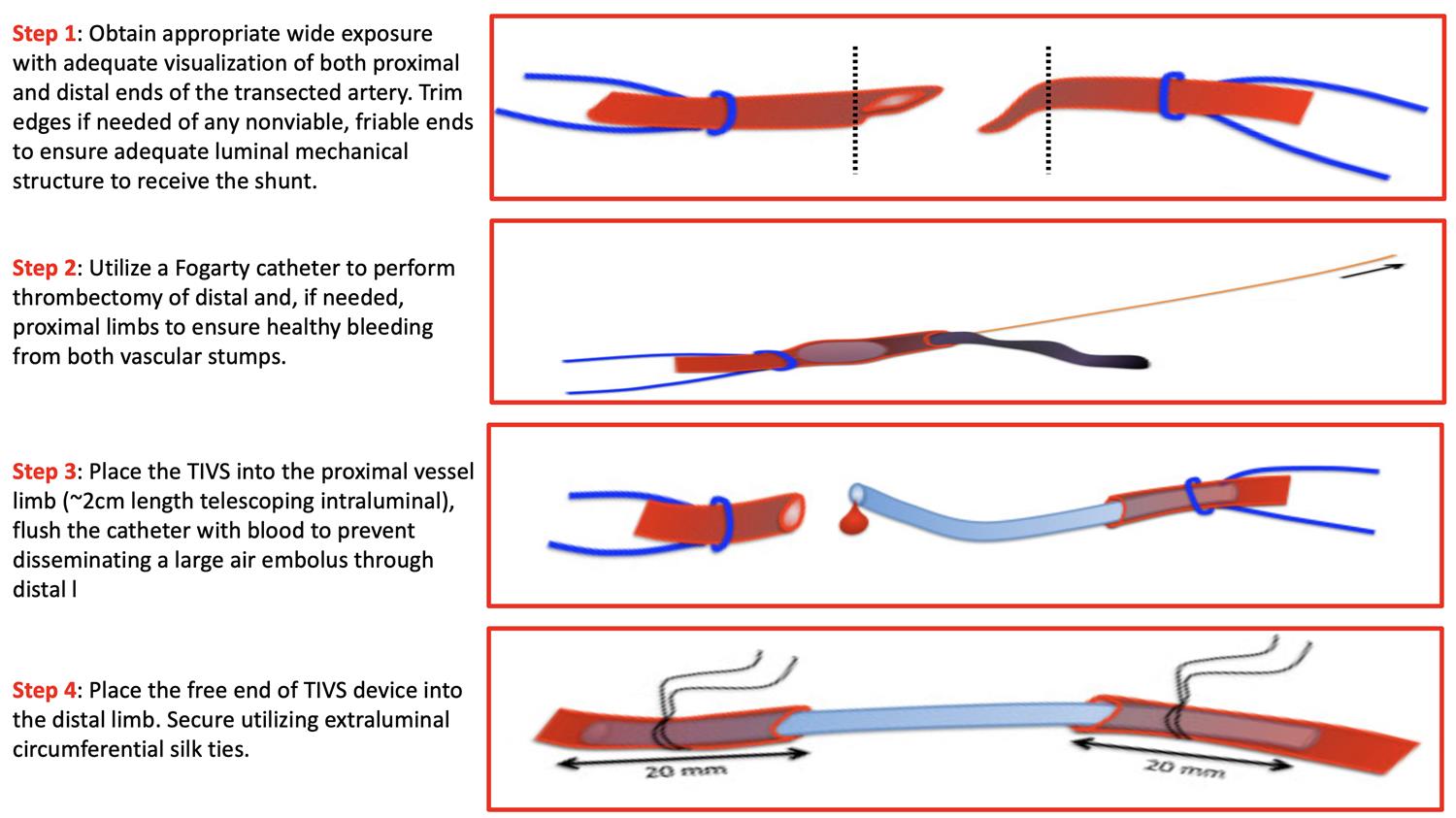 Question 219190 - Qbank - Orthobullets
