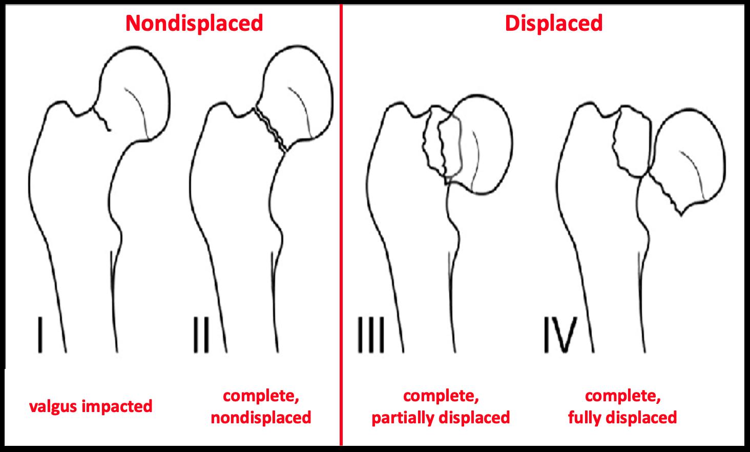 Question 219193 - Qbank - Orthobullets
