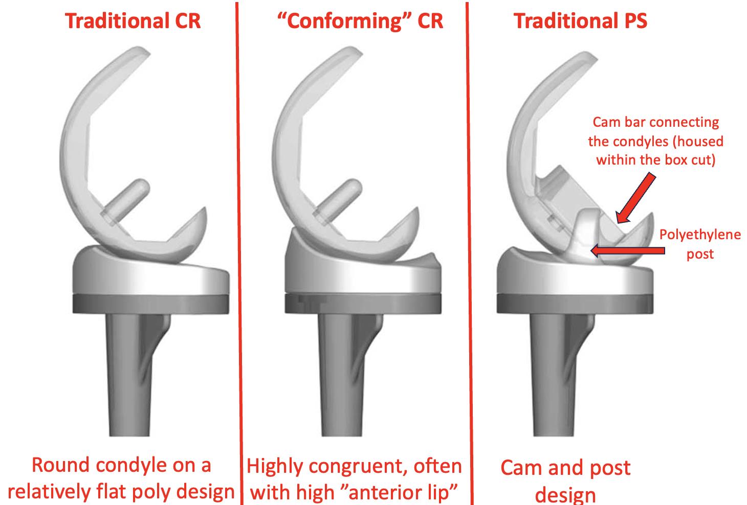 Question 219224 - Qbank - Orthobullets