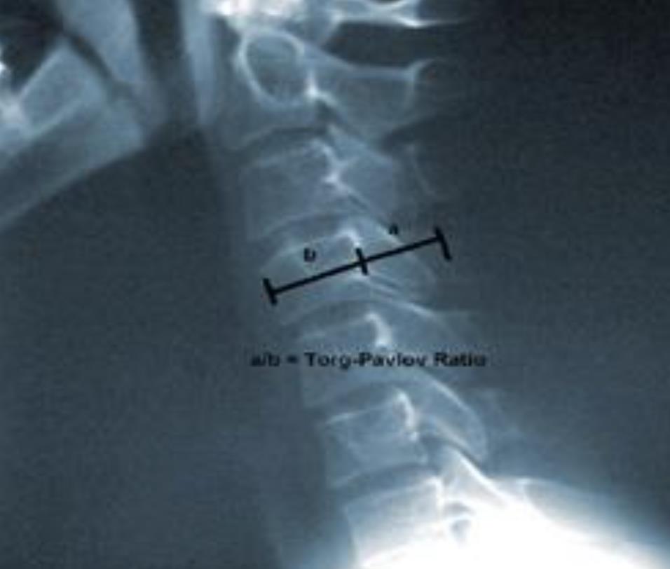 Question 219306 - Qbank - Orthobullets