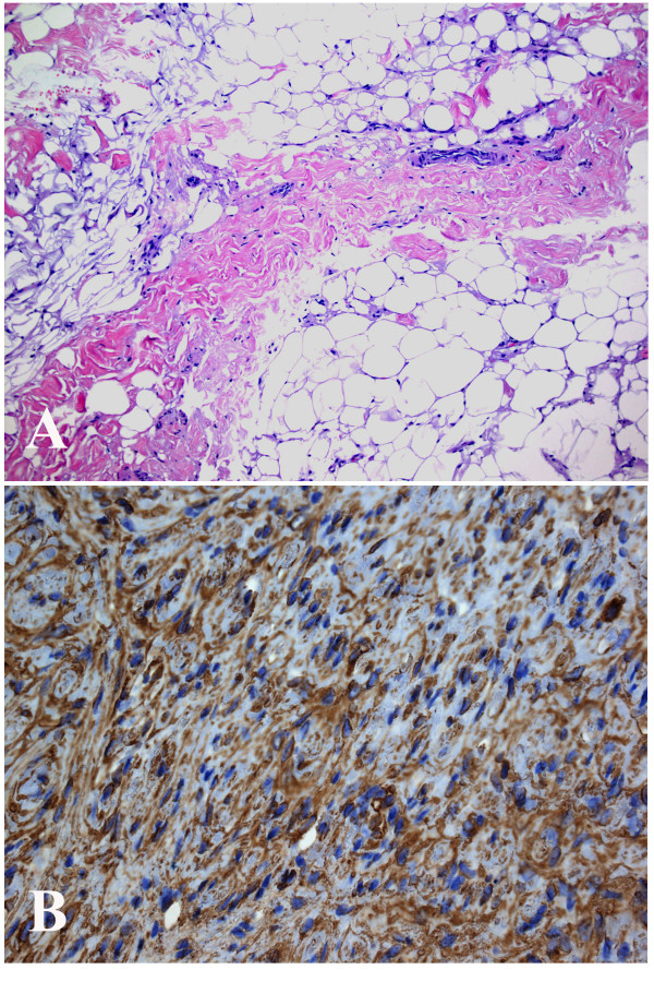 Question 219338 - Qbank - Orthobullets