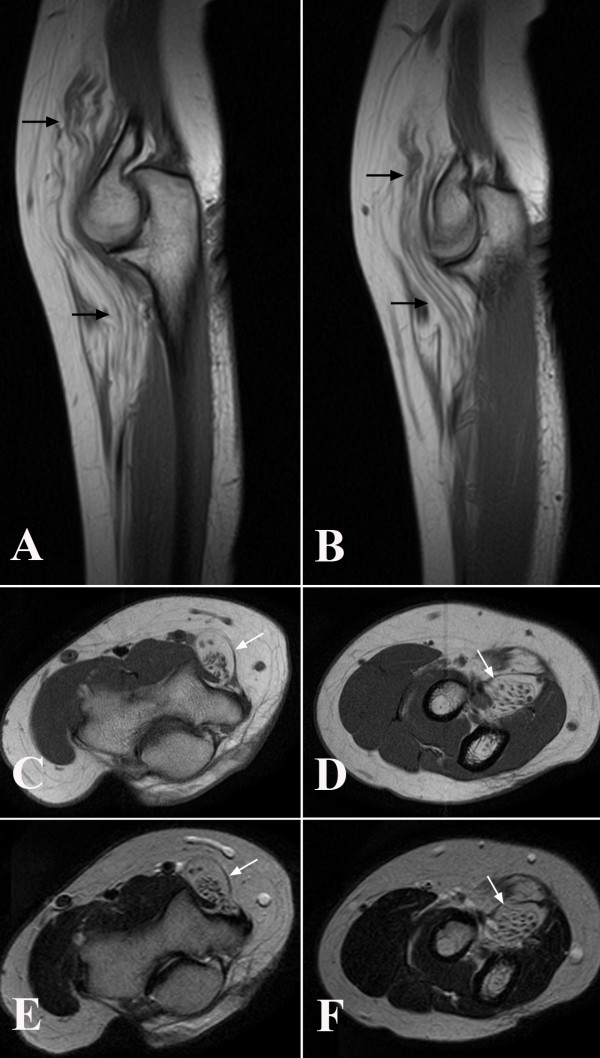 Question 219338 - Qbank - Orthobullets