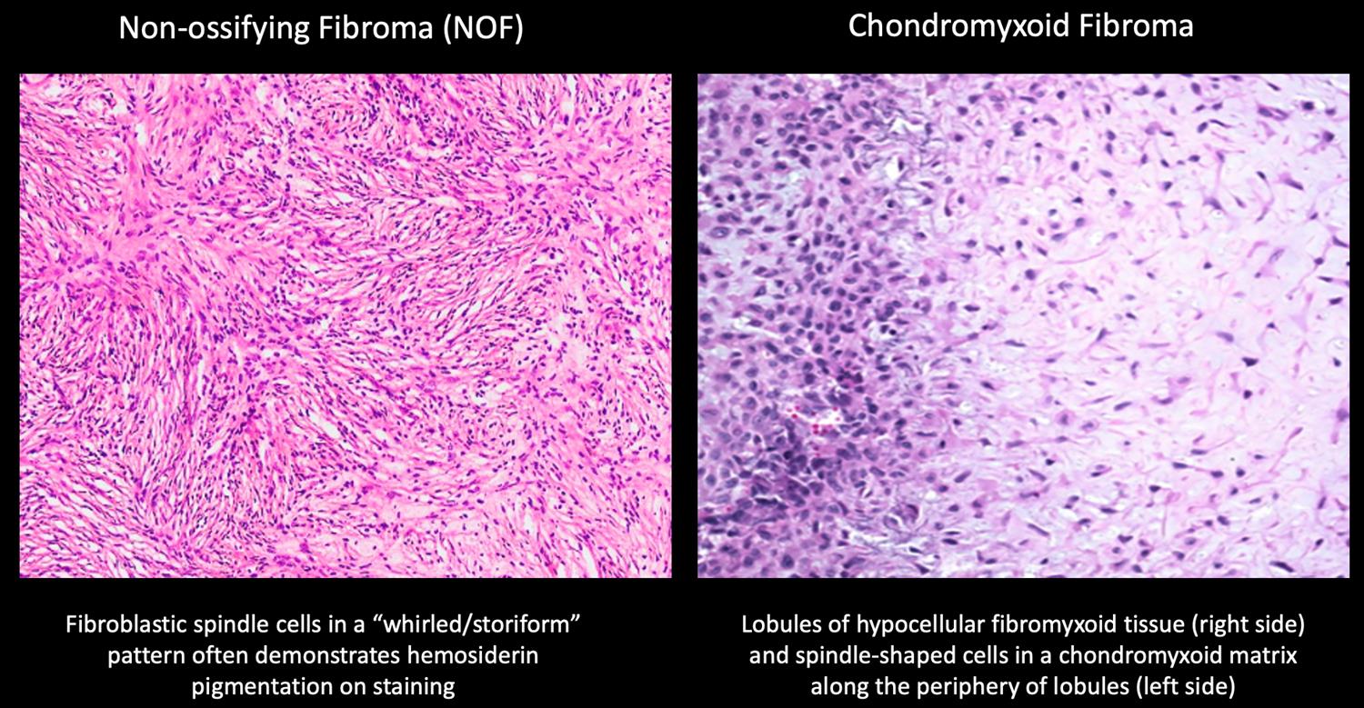 Question 219386 - Qbank - Orthobullets