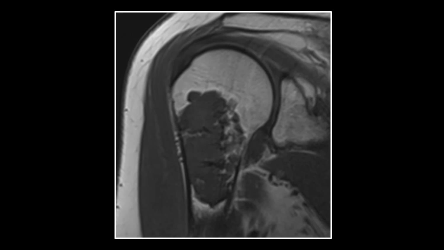 Pelvis Anatomy Recon Orthobullets