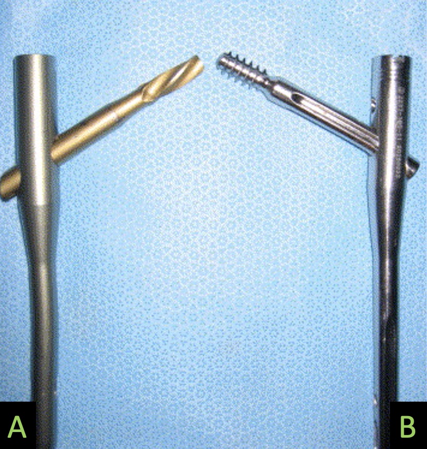 Question 219464 - Qbank - Orthobullets