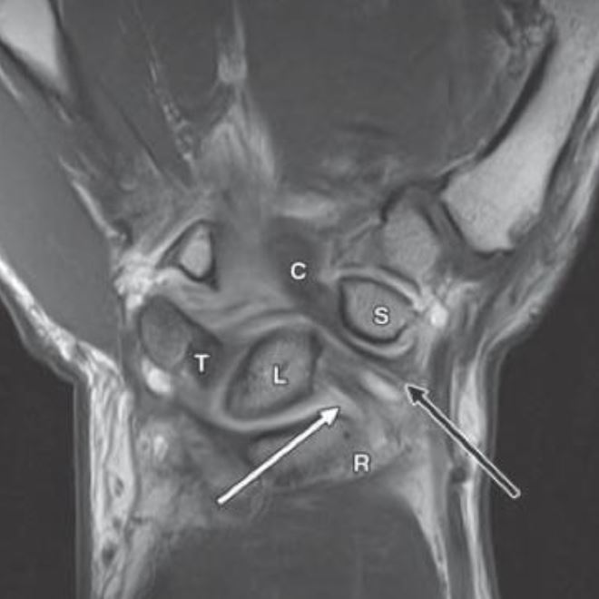 Question 219520 - Qbank - Orthobullets