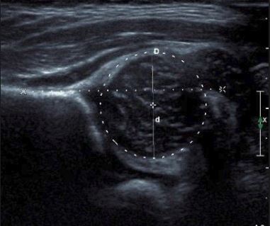 Question 2201 - Qbank - Orthobullets