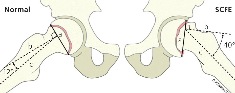 Question 2234 - Qbank - Orthobullets