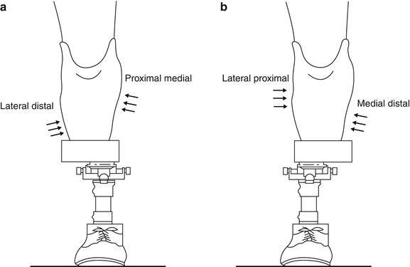 Question 23 - Qbank - Orthobullets