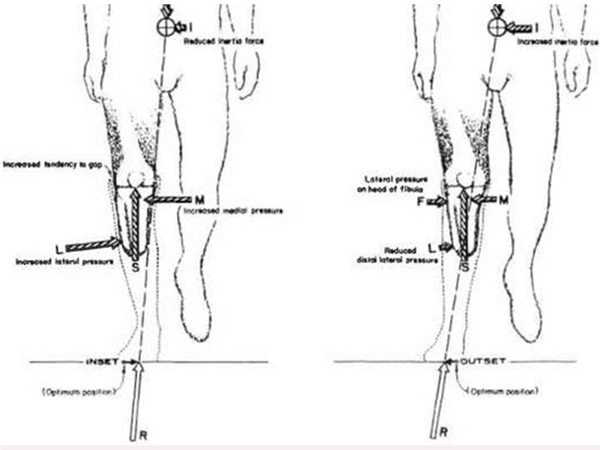 Question 23 - Qbank - Orthobullets
