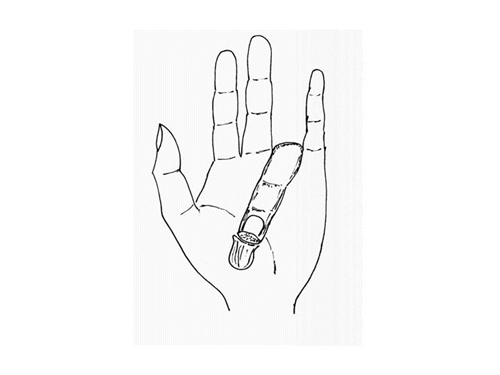 Fingertip Amputations & Finger Flaps - Hand - Orthobullets