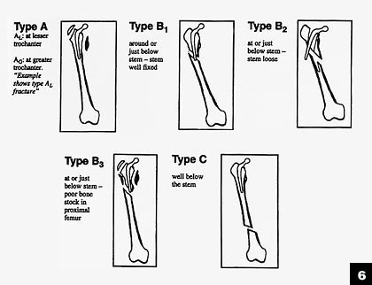 Question 2953 - Qbank - Orthobullets