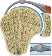 Question 3086 - Qbank - Orthobullets