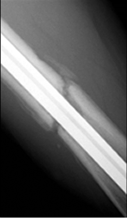 Question 3243 - Qbank - Orthobullets