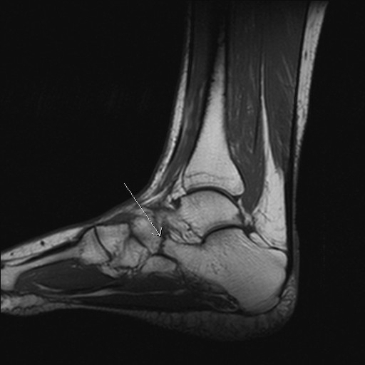 Question 334 - Qbank - Orthobullets