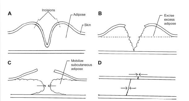 Question 3431 - Qbank - Orthobullets