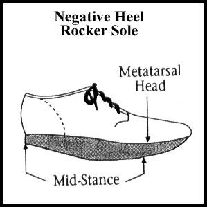 Ankle Arthritis - Foot & Ankle - Orthobullets