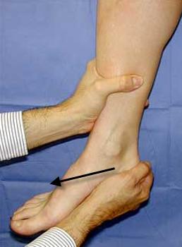 Question 3491 - Qbank - Orthobullets