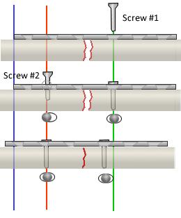 Question 358 - Qbank - Orthobullets