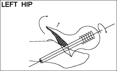Question 3612 - Qbank - Orthobullets