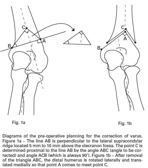 Question 3651 - Qbank - Orthobullets