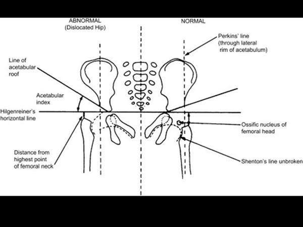 Question 3658 - Qbank - Orthobullets