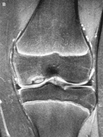 Question 3697 - Qbank - Orthobullets