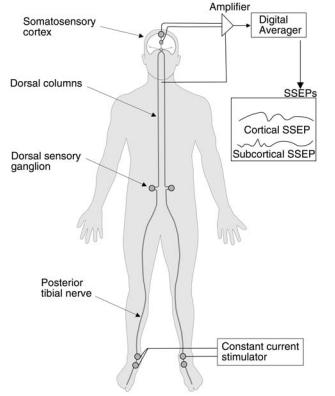 Question 3700 - Qbank - Orthobullets