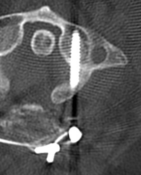 Question 3762 - Qbank - Orthobullets