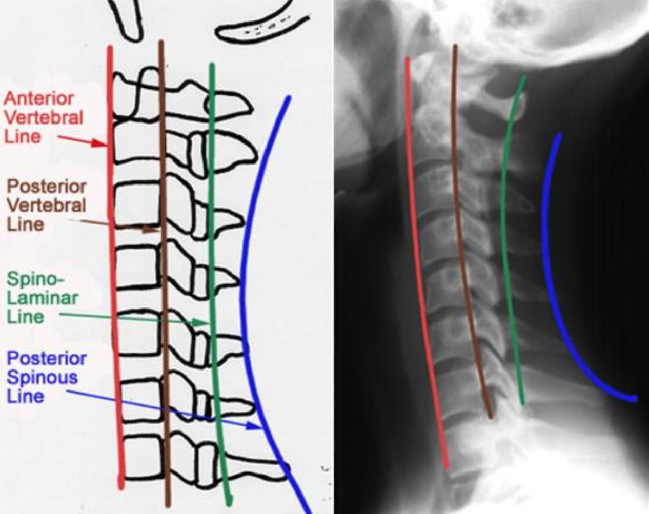 Question 3765 - Qbank - Orthobullets