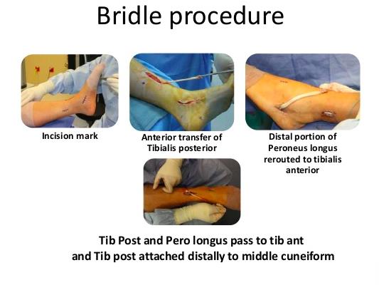 Question 3813 - Qbank - Orthobullets