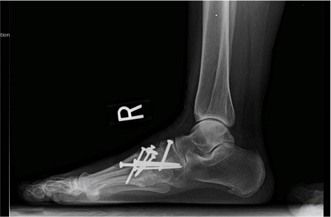 Question 3822 - Qbank - Orthobullets