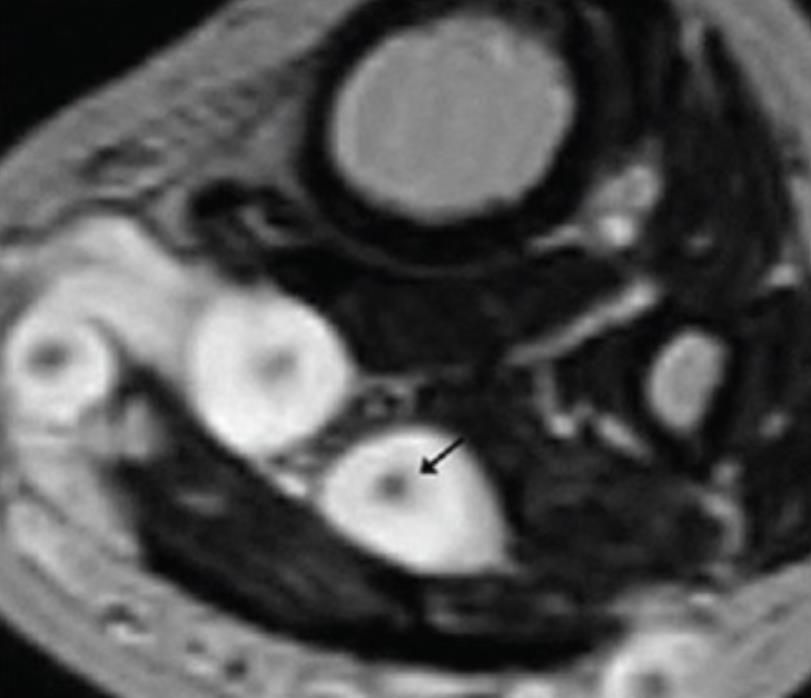 Question 3849 - Qbank - Orthobullets