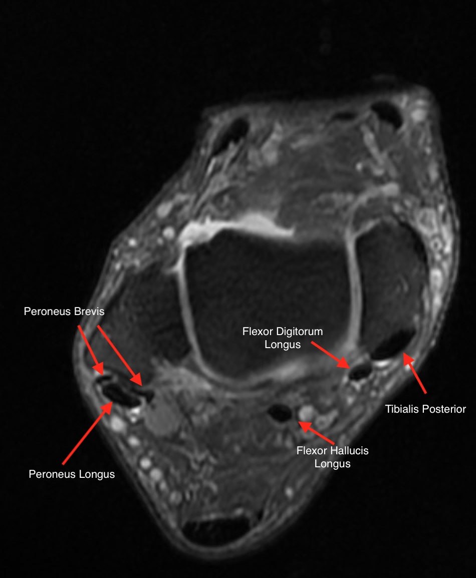 Question 3857 - Qbank - Orthobullets