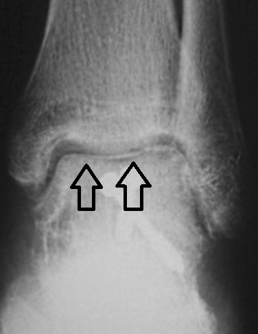 Question 3874 - Qbank - Orthobullets