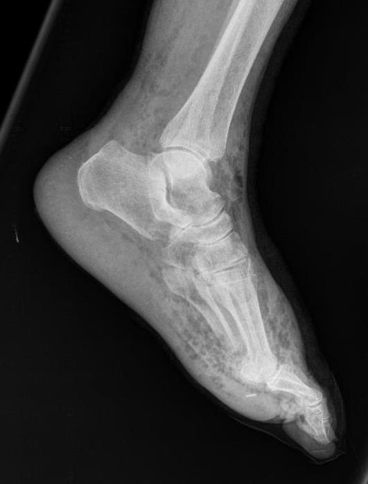 Question 3875 - Qbank - Orthobullets