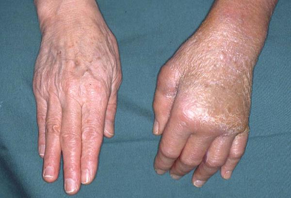 Question 3903 - Qbank - Orthobullets