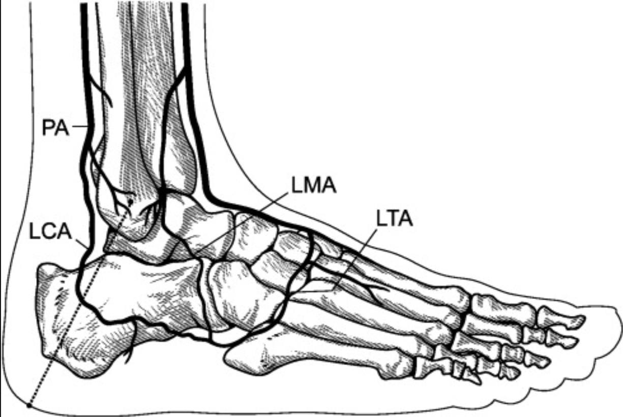 Question 3904 - Qbank - Orthobullets