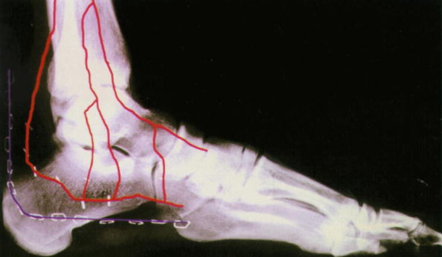 Question 3904 - Qbank - Orthobullets
