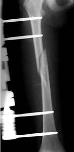 Question 3917 - Qbank - Orthobullets