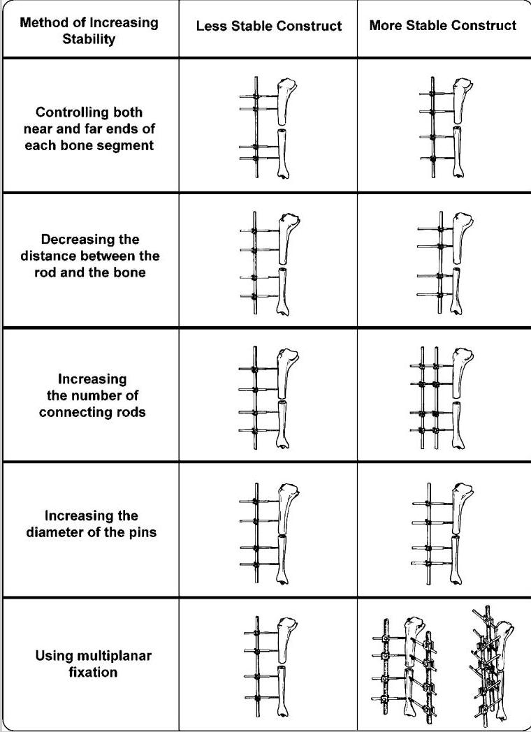 Question 3943 - Qbank - Orthobullets