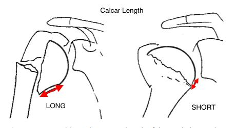 Question 4012 - Qbank - Orthobullets
