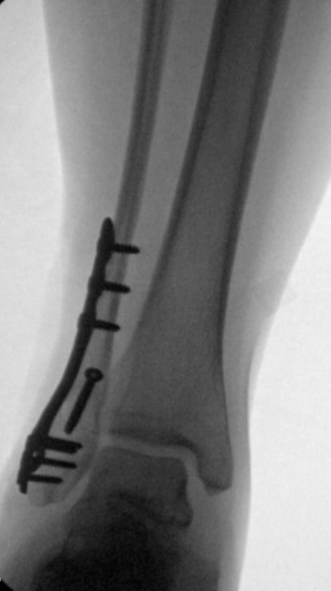 Question 4018 - Qbank - Orthobullets